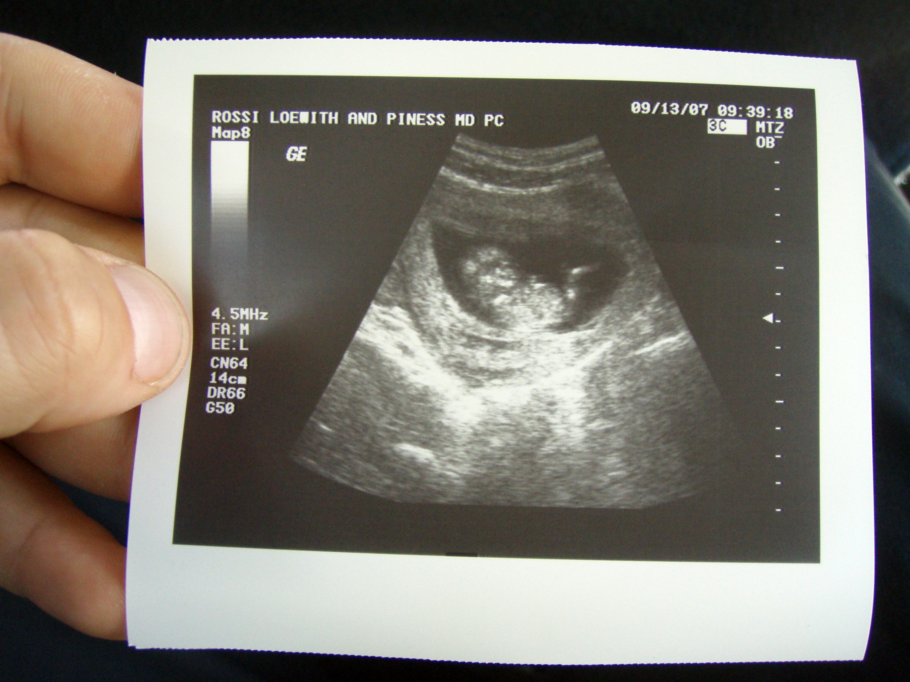 What Is An Umbilical Cord? 3 Things To Know About Your Baby’s Lifeline